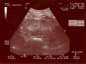 Prostaatproblemen bij de hond - Dierenkliniek Tiel-Drumpt