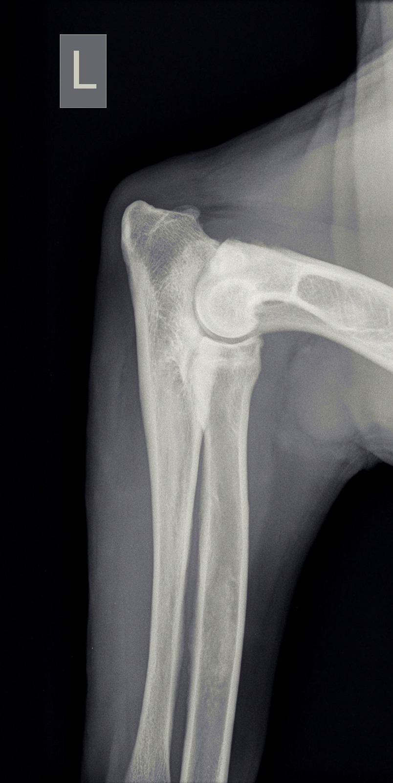 Enostose of groeipijn bij de hond- Dierenkliniek Tiel-Drumpt