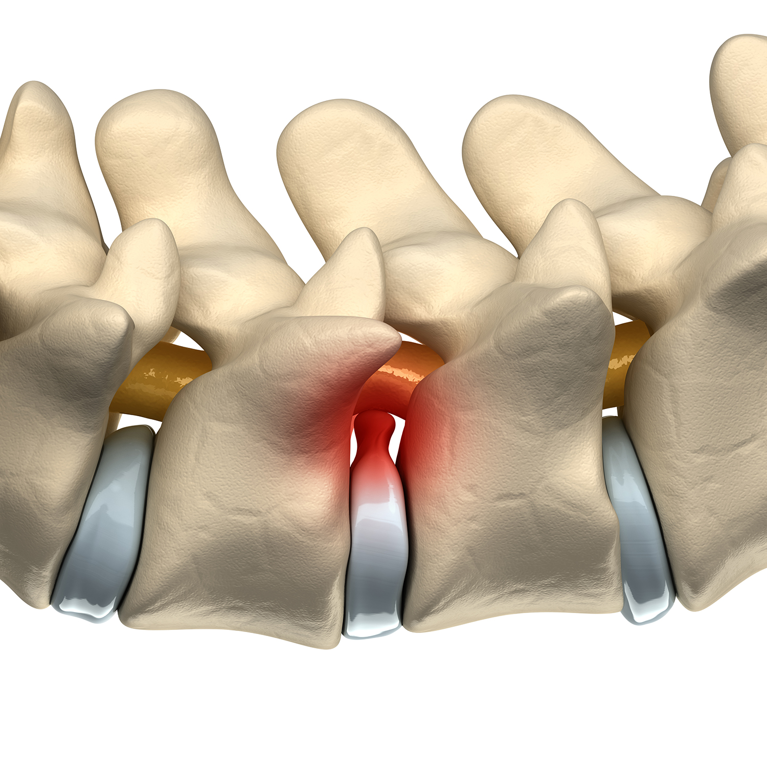 Rughernia of nekhernia bij de hond - Dierenkliniek Tiel-Drumpt